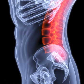Understanding the Common Causes of Back Pain | Coastal Carolinas ...